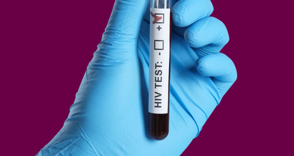 HIV: como é feito o exame? - Blog da Alice